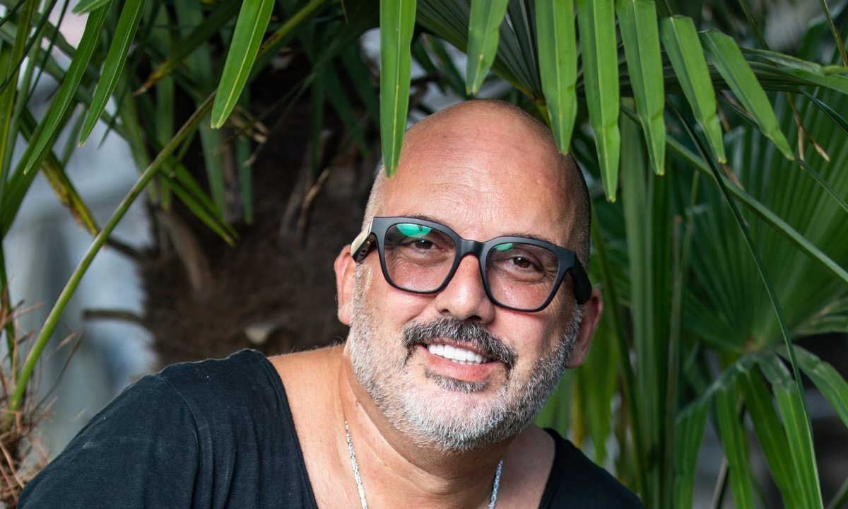 Tony Cetinski bio na presađivanju kose, objavio je i prve fotografije ...