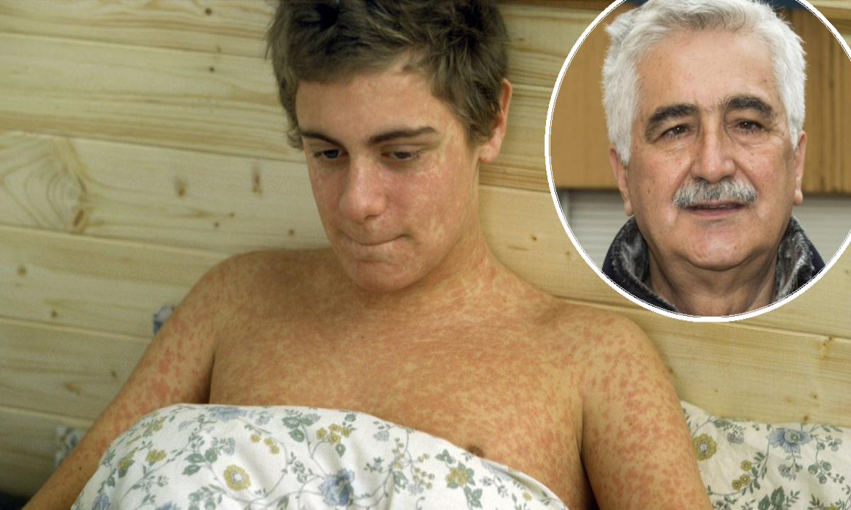 Morbile uzele prve žrtve u BiH. Hrvatski epidemiolog: 'Pod stalnom smo ...