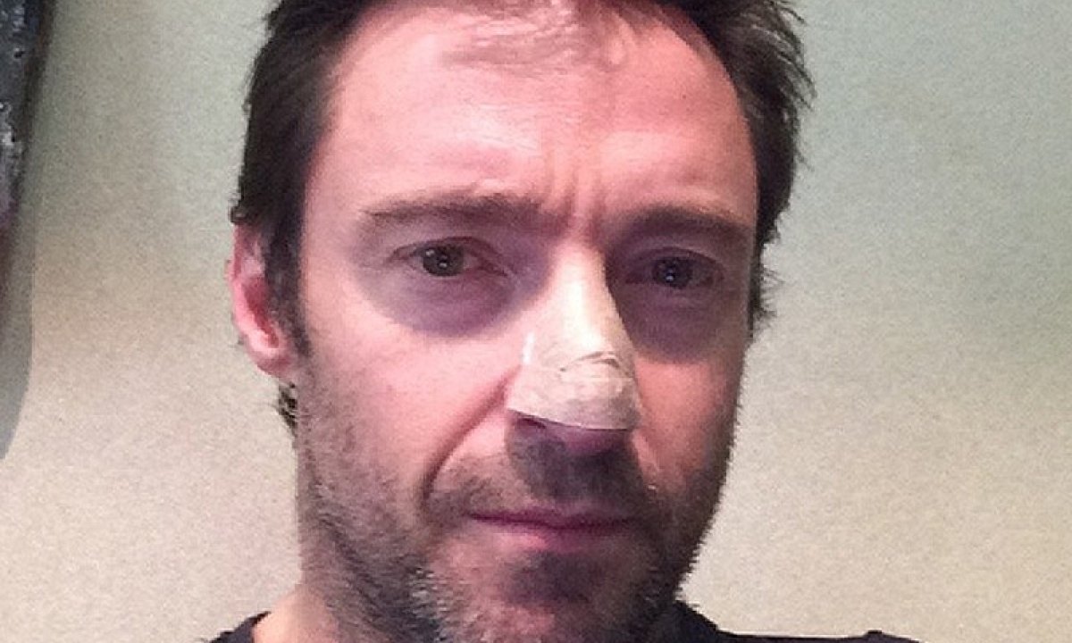 Hugh Jackman objavio da ima rak - tportal