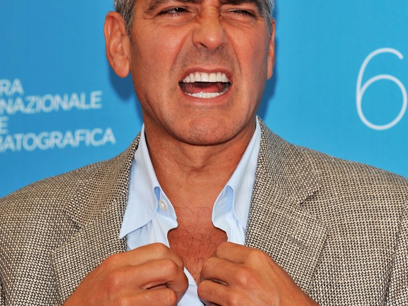 George Clooney sam sebi slomio ruku - tportal