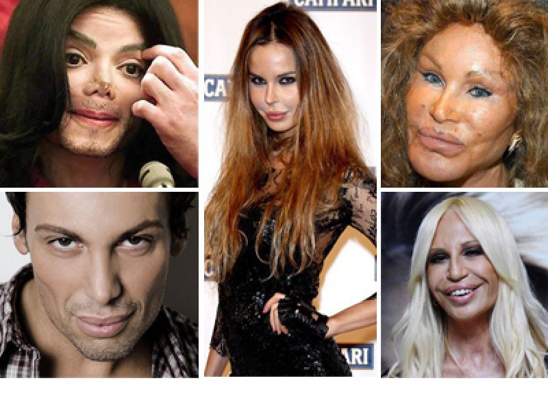 Najgore plastične operacije slavnih - tportal