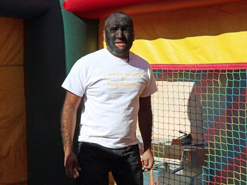 Upoznajte Larryja Gomeza – najdlakavijeg čovjeka na svijetu - tportal