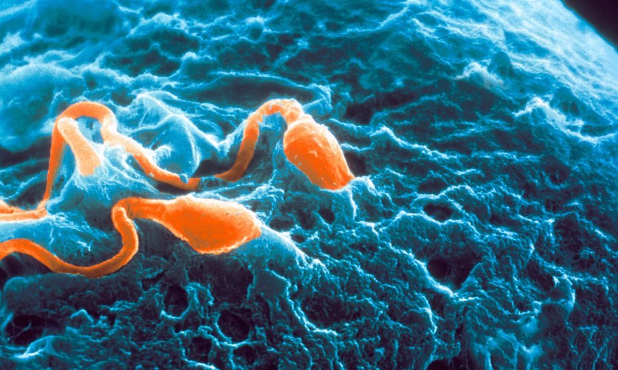 Upozorenje parovima: Broj i pokretljivost spermija narušeni više ...